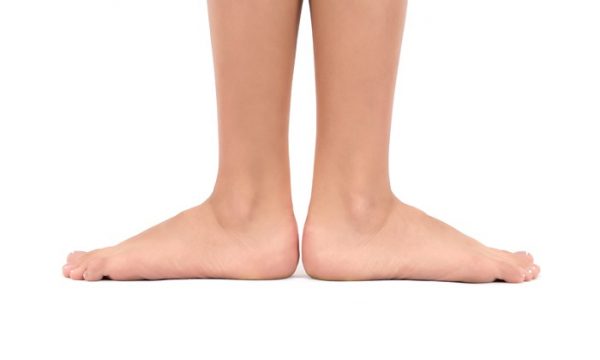 Flexible Flatfoot Treatment Pune | Dr. Chetan Oswal