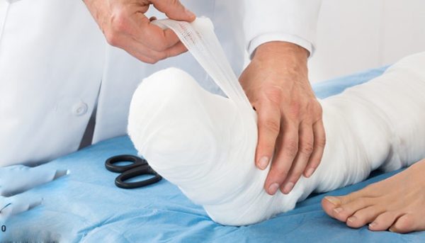 Foot Fusion Surgery Treatment Pune, Pimpri Chinchwad | Orthowin Foot ...