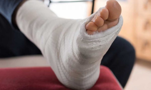 Pilon Fractures Treatment in Pune | Dr. Chetan Oswal