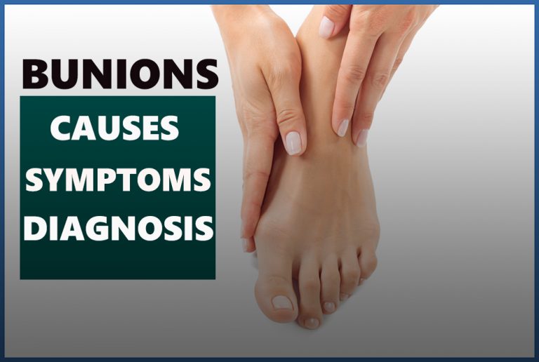 What are Bunions: Causes, Symptoms, & Diagnosis | Dr. Chetan Oswal ...