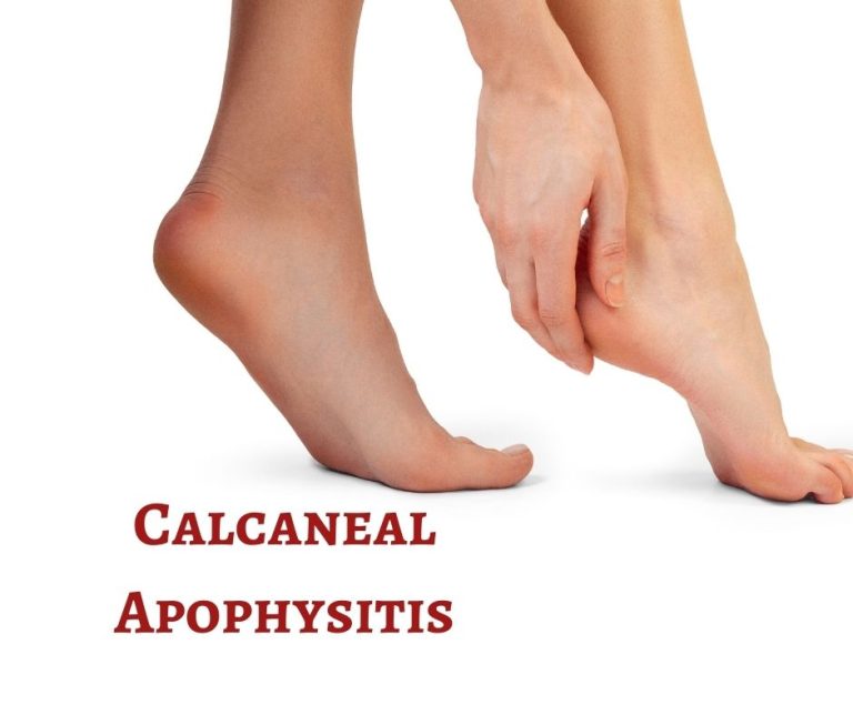 Calcaneal Apophysitis | Dr. Chetan Oswal, Pune