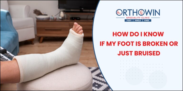 How do I know if my foot is broken or just bruised - Pune Foot Ankle